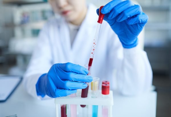 Blood and Urine Culture Testing - STD