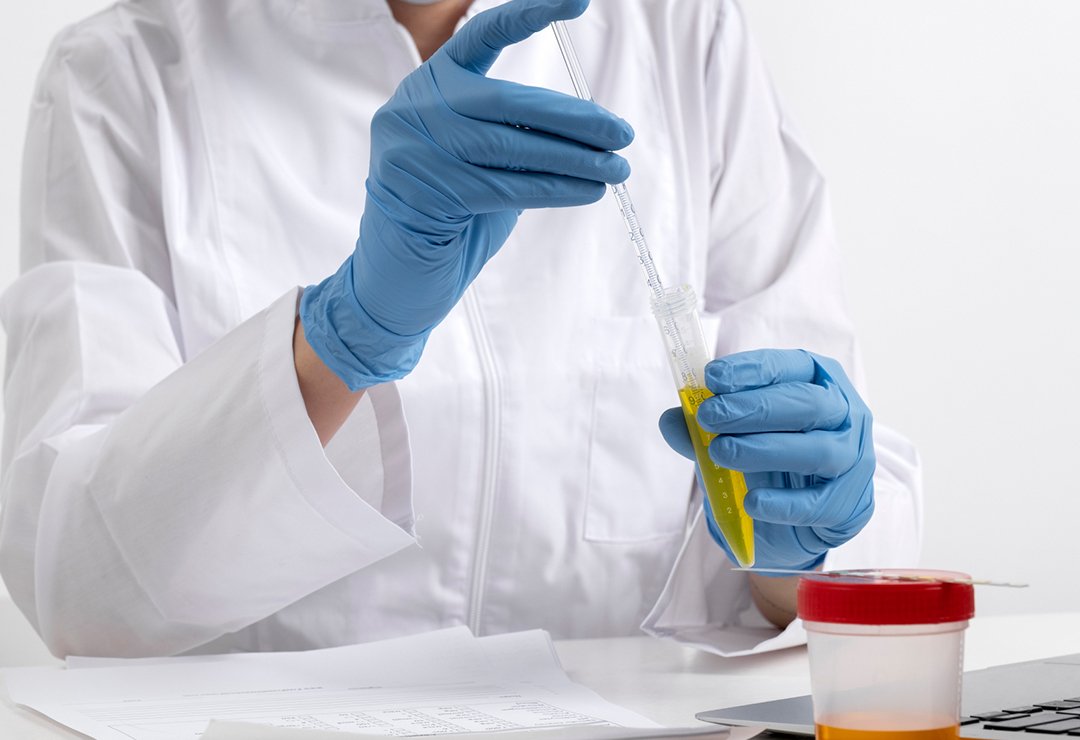 Gonorrhea Testing - STD