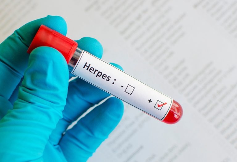 Herpes Testing - STD