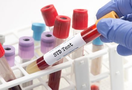 At Home STD Check | STD Testing at Home Dubai